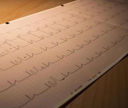 ECG Services | Cardiac Diagnostics - Diagnostic Healthcare